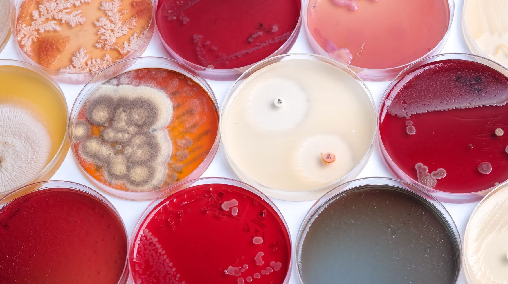 Renaissance BioScience secures Genome BC funding to build yeast ...